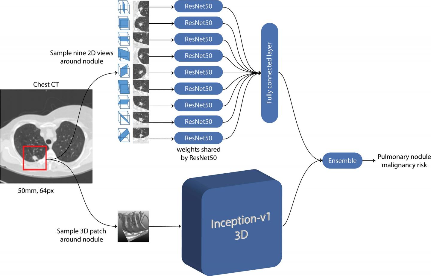 AI predicts lung cancer risk | EurekAlert!
