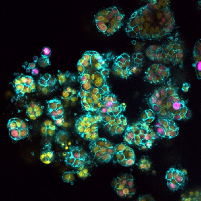 Pancreatic cancer cells [IMAGE] | EurekAlert! Science News Releases