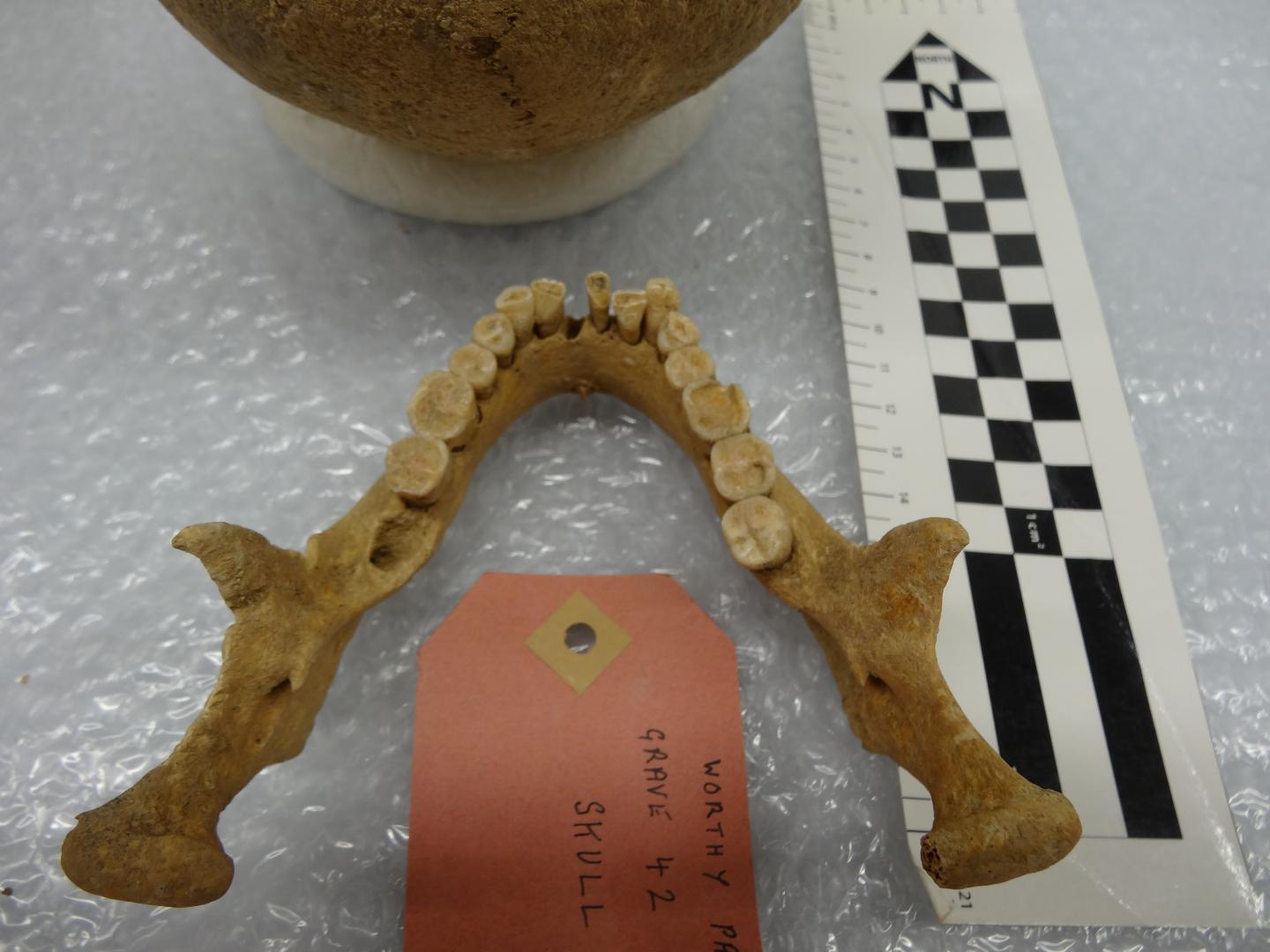 Teeth from the Middle Ages (2 [IMAGE] | EurekAlert! Science News Releases