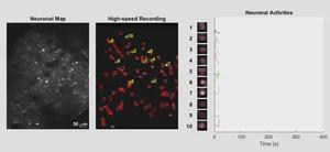 New microscope offers faster, high-resolution | EurekAlert!