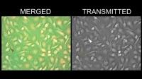 NIH scientists show how tularemia bacteria tr | EurekAlert!