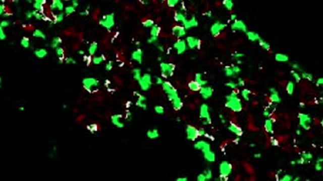 A new way to generate insulin-producing cells | EurekAlert!