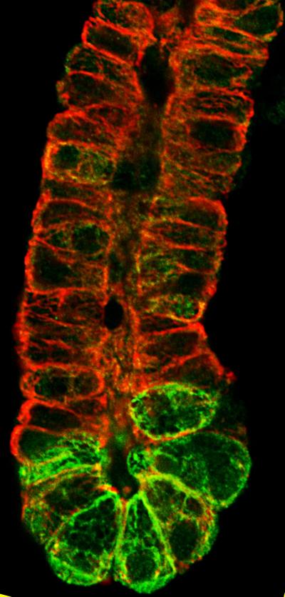 EB2 Expressed in the Stem Cell [IMAGE] | EurekAlert! Science News Releases