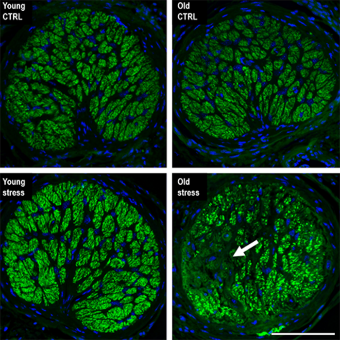 Optic Nerve Head [IMAGE] | EurekAlert! Science News Releases