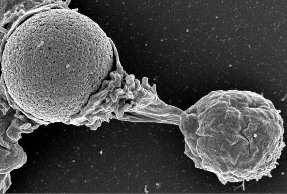 White blood cell protrusion [IMAGE] | EurekAlert! Science News Releases