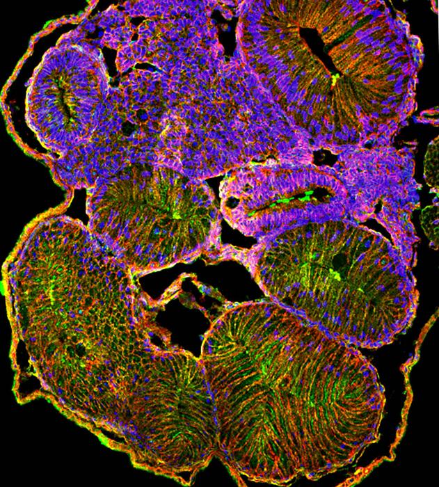 A transverse section through t [IMAGE] | EurekAlert! Science News Releases
