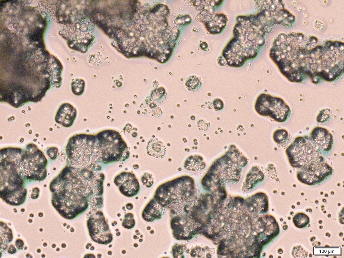 Chytrid Fungus Interacts with [IMAGE] | EurekAlert! Science News Releases