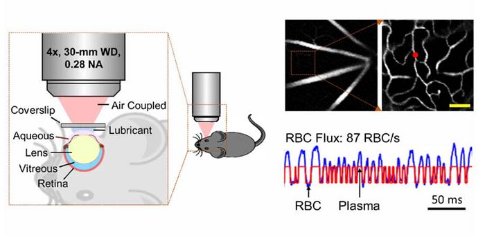 Eyeing the brain: Predicting cerebrovascular | EurekAlert!