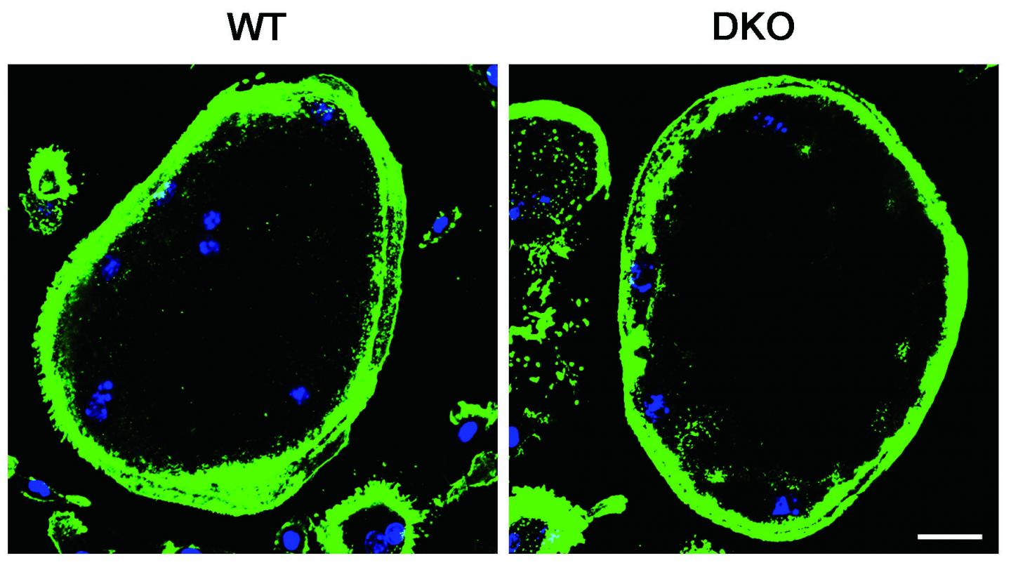 Hampering Bone Breakdown Prote [IMAGE] | EurekAlert! Science News Releases