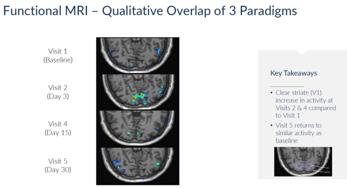 Functional MRI from ABACUS stu [IMAGE] | EurekAlert! Science News Releases