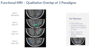 Kiora's investigational treatment for retinit | EurekAlert!