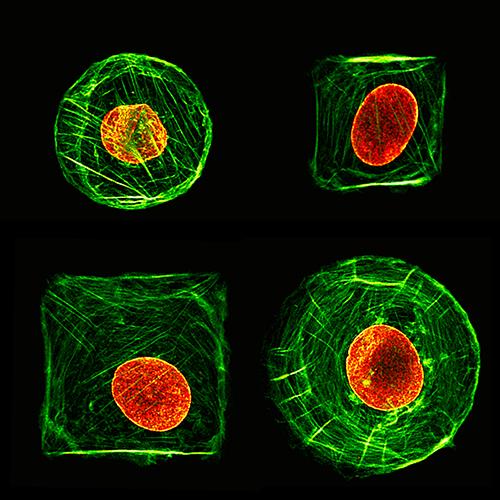 Fibroblast Cells [IMAGE] | EurekAlert! Science News Releases