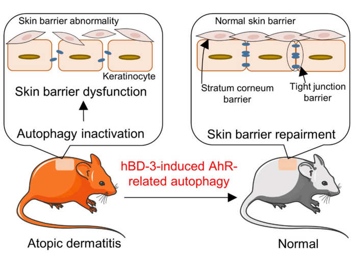 Dysfunctional autophagy plays [IMAGE] | EurekAlert! Science News Releases