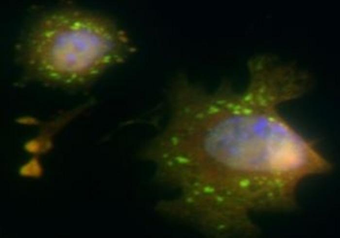 Scientists shed light on how stressed cells s | EurekAlert!