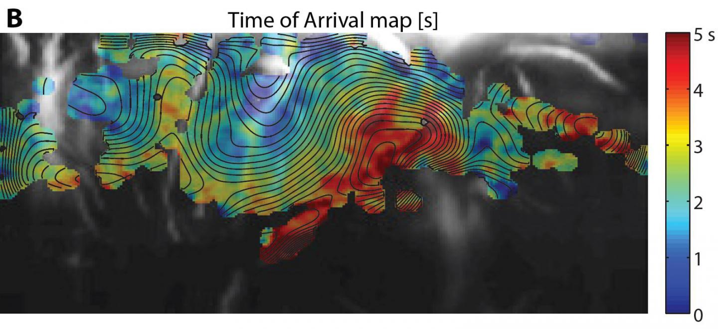 A Portable Bedside Brain Scanner for Babies ( | EurekAlert!