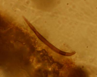 Ancient Carnivorous Fungi Lassoed its Prey (3 | EurekAlert!