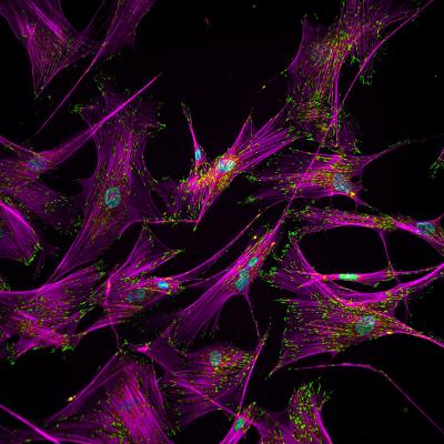 Adult Fibroblast Cells [IMAGE] | EurekAlert! Science News Releases