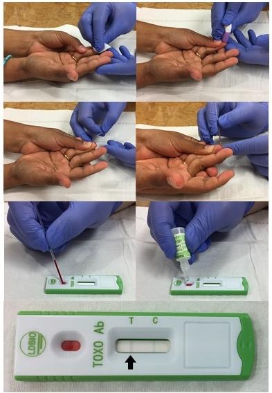 Whole Blood Test for Toxoplasm [IMAGE] | EurekAlert! Science News Releases