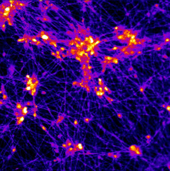 Firing Neurons [IMAGE] | EurekAlert! Science News Releases
