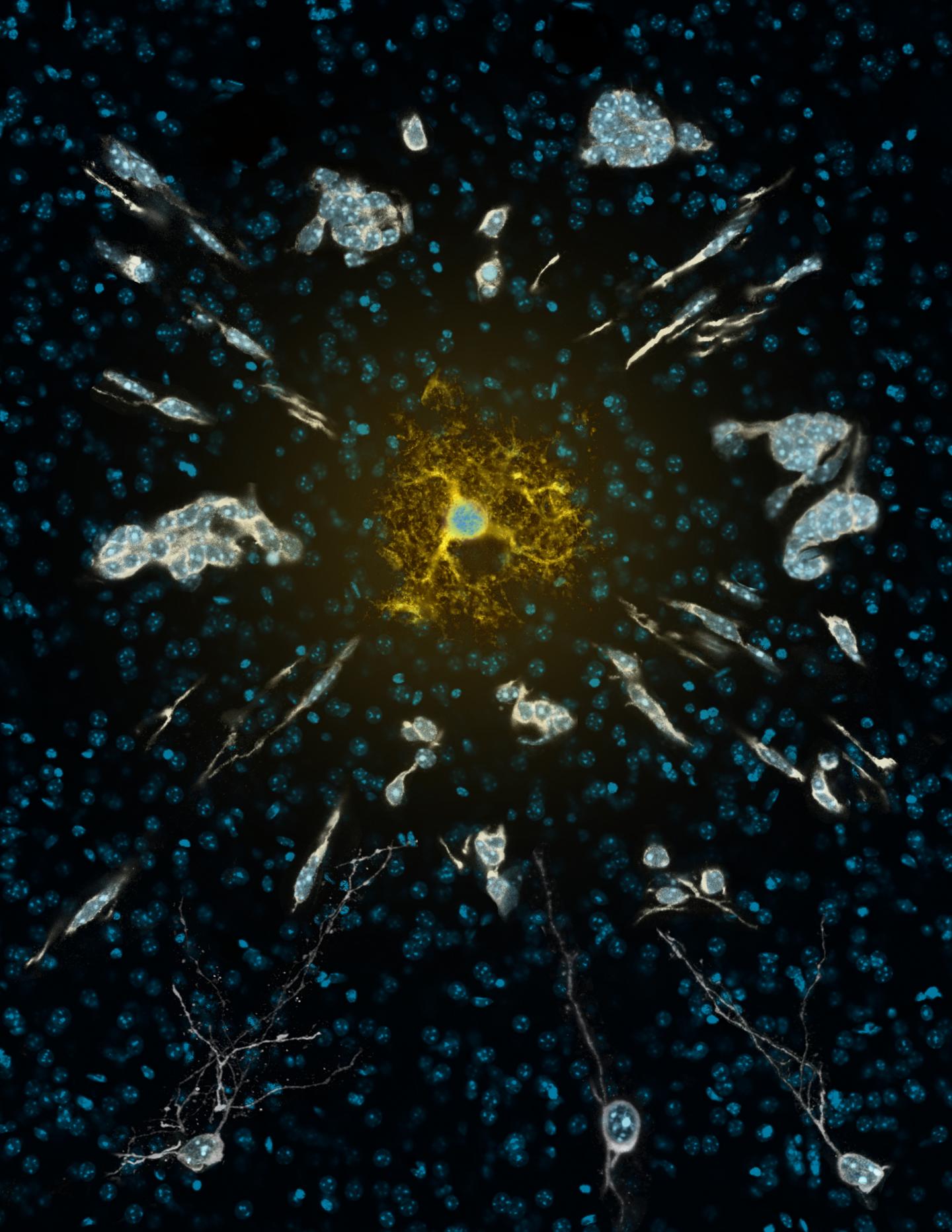 The Hidden Talents of Astrocyt [IMAGE] | EurekAlert! Science News Releases