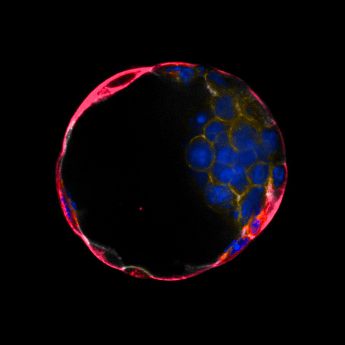 A mouse blastoid fluorescently [IMAGE] | EurekAlert! Science News Releases