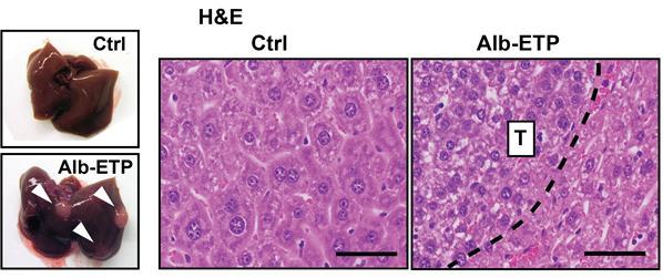 ETP Overexpression in Liver Ti [IMAGE] | EurekAlert! Science News Releases