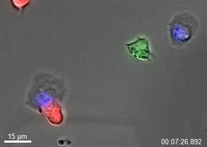 New immunotherapy for multiple [VIDEO] | EurekAlert! Science News Releases