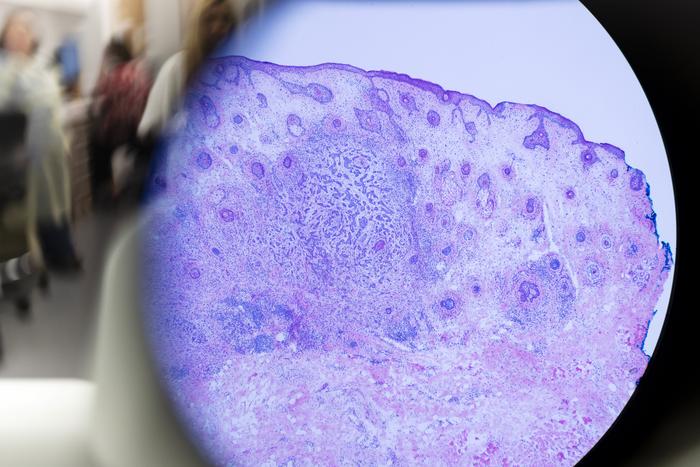 MSK Microscope [IMAGE] | EurekAlert! Science News Releases