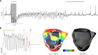 Termination of lethal arrhythmia with light | EurekAlert!