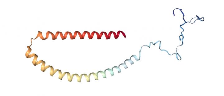 New mechanism behind Parkinson's disease reve | EurekAlert!