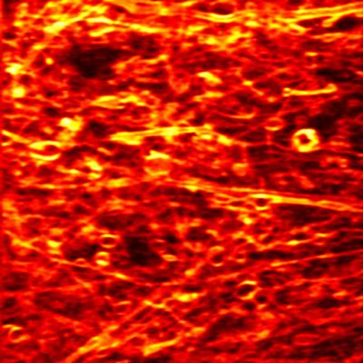Watching Molecules Move In Live Cells (1 of 4 | EurekAlert!