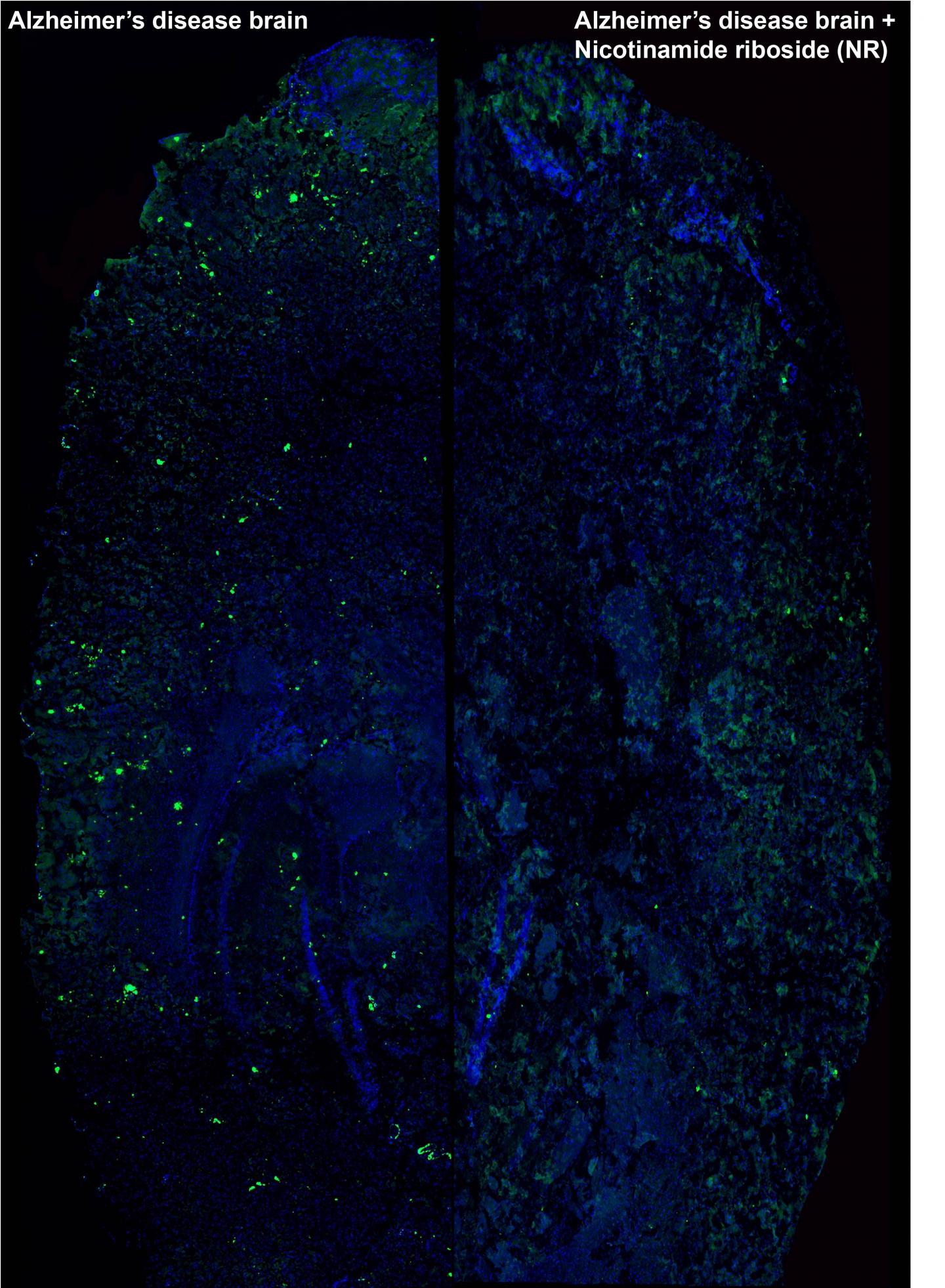 Brain Sections of Alzheimer's [IMAGE] | EurekAlert! Science News Releases