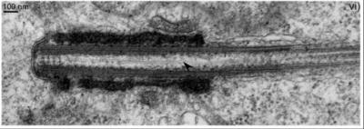 Cytoskeleton Electron Micrograph