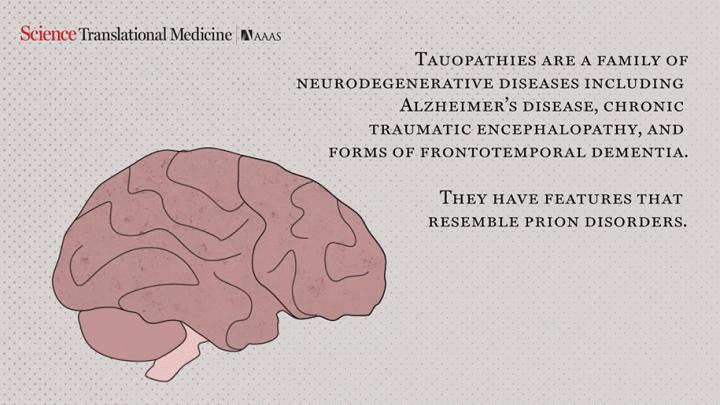 Keeping Tabs on Tau to Track Neurodegenerativ | EurekAlert!