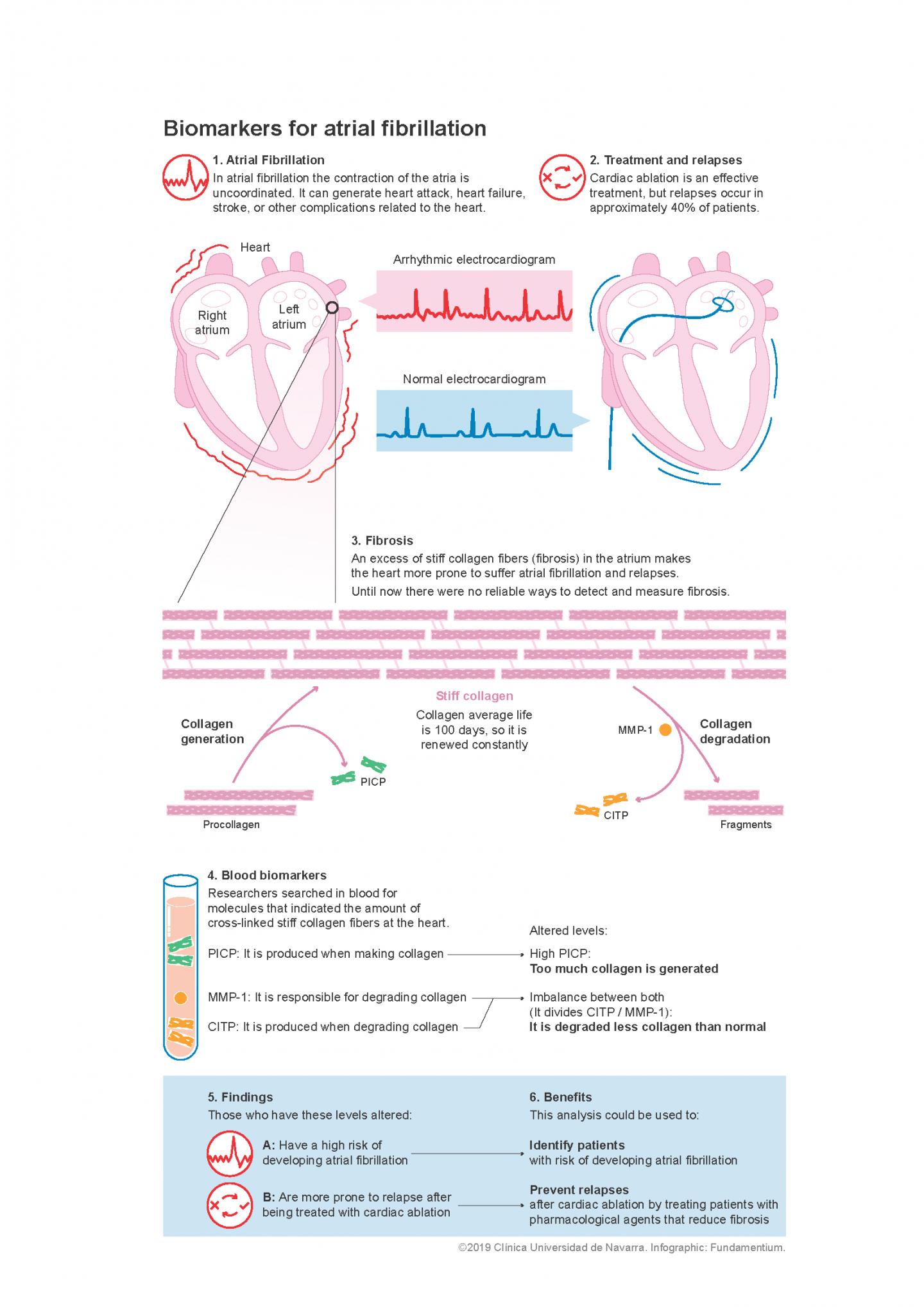 Biomarkers for Atrial Fibrilla [IMAGE] | EurekAlert! Science News Releases