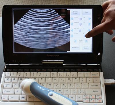 Netbook Ultrasound Interface [IMAGE] | EurekAlert! Science News Releases