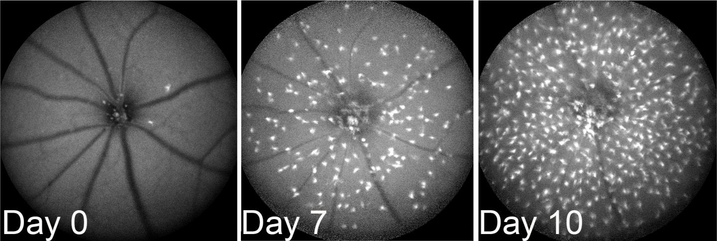 Microglia Repopulating Retina [IMAGE] | EurekAlert! Science News Releases