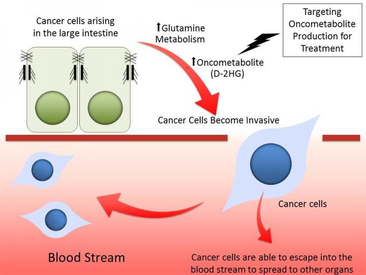 大腸がんの転移にはオンコメタボライトが関与する | EurekAlert!