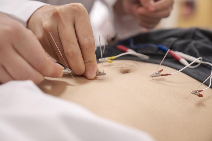 Electro-acupuncture [IMAGE] | EurekAlert! Science News Releases
