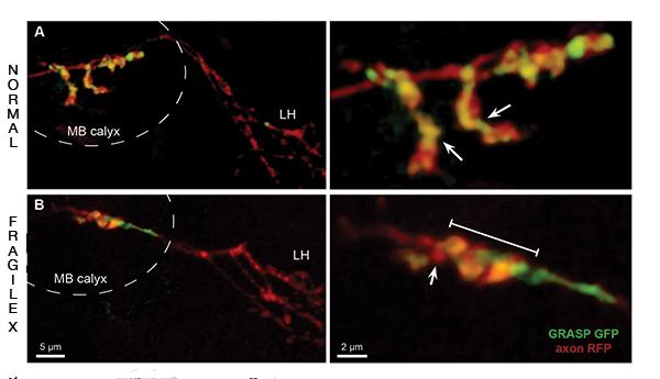 Fragile X Memory-Sensory Neuro [IMAGE] | EurekAlert! Science News Releases