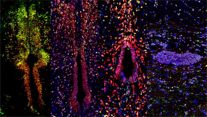 Ventricular zone development [IMAGE] | EurekAlert! Science News Releases