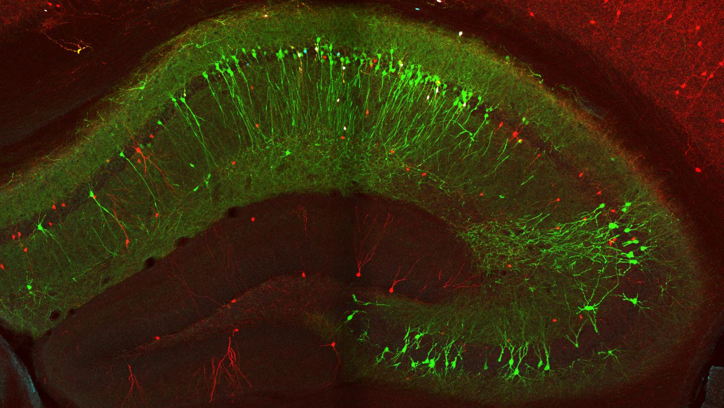 VIP Cells in Hippocampus [IMAGE] | EurekAlert! Science News Releases