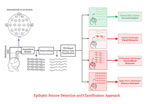 Detecting seizures and interpreting EEGs, th | EurekAlert!