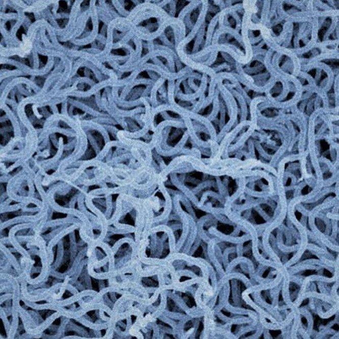 Borrelia [IMAGE] | EurekAlert! Science News Releases