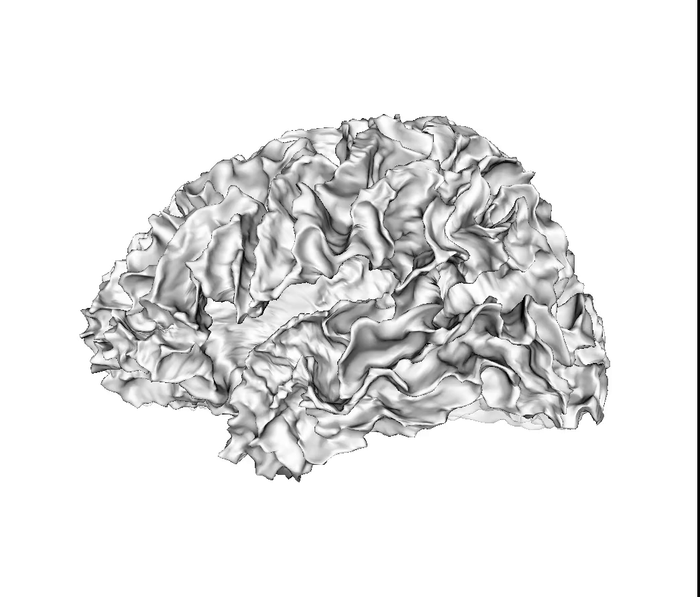 Visual system brain development implicated in | EurekAlert!