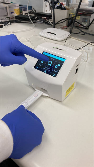 Malaria Test [IMAGE] | EurekAlert! Science News Releases