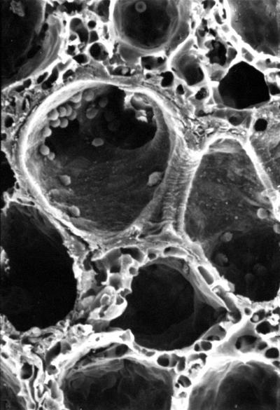 Biochemical signals associated with atheroscl | EurekAlert!