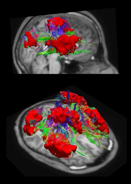 A new atlas of the brain opens up alternative | EurekAlert!