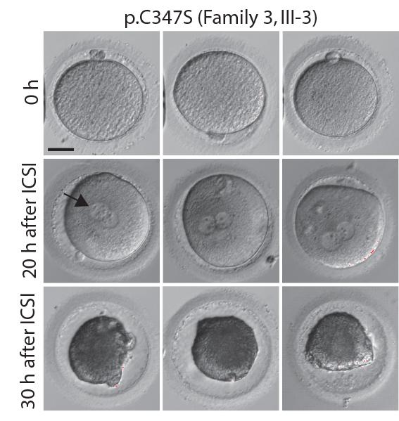 Study Reveals the Genetic Origins of an Inher | EurekAlert!
