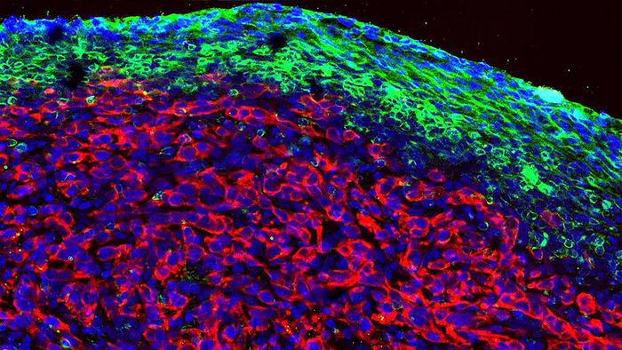 Old chemo drug, new pancreatic cancer therapy | EurekAlert!